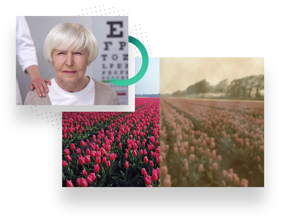 Staar (Cataract) - Augenärzte Gerl & Kollegen - augenklinik.de